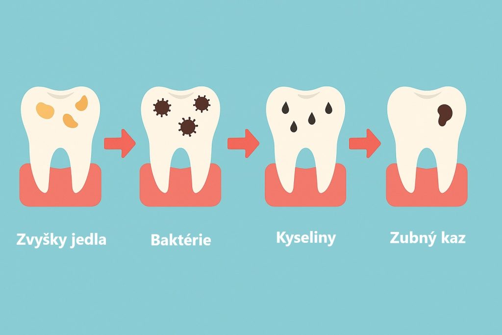 Ako spoznať zubný kaz? | Bielime